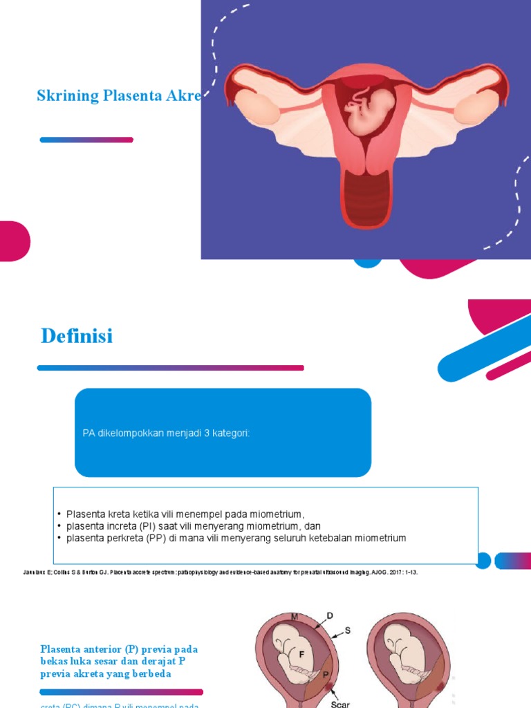 Skrining Plasenta Akreta | PDF
