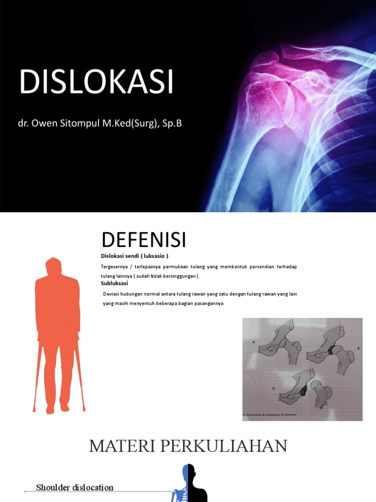 Penanganan Dislokasi Sendi dan Tulang | PDF