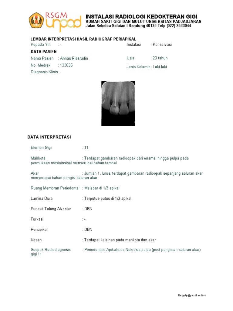 10 - Interpretasi Periapikal 11 21 - Annas Riasrudin | PDF | Sains ...