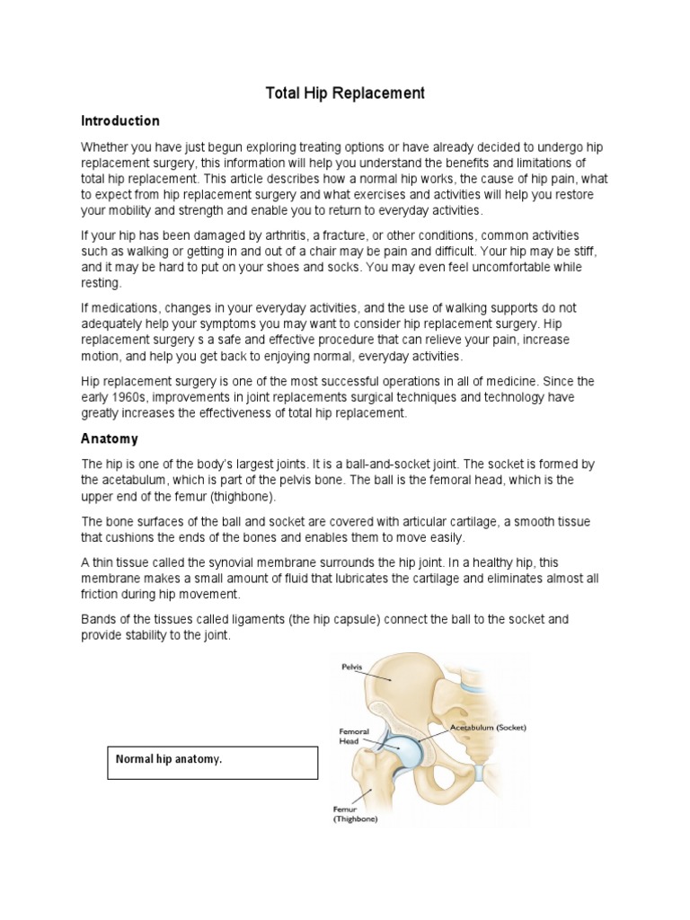 Total Hip Replacement - Educational Packet | PDF | Arthritis | Surgery