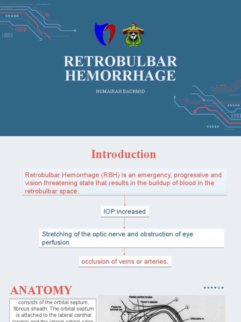 Anatomy, Causes, Diagnosis, and Management of Retrobulbar Hemorrhage ...