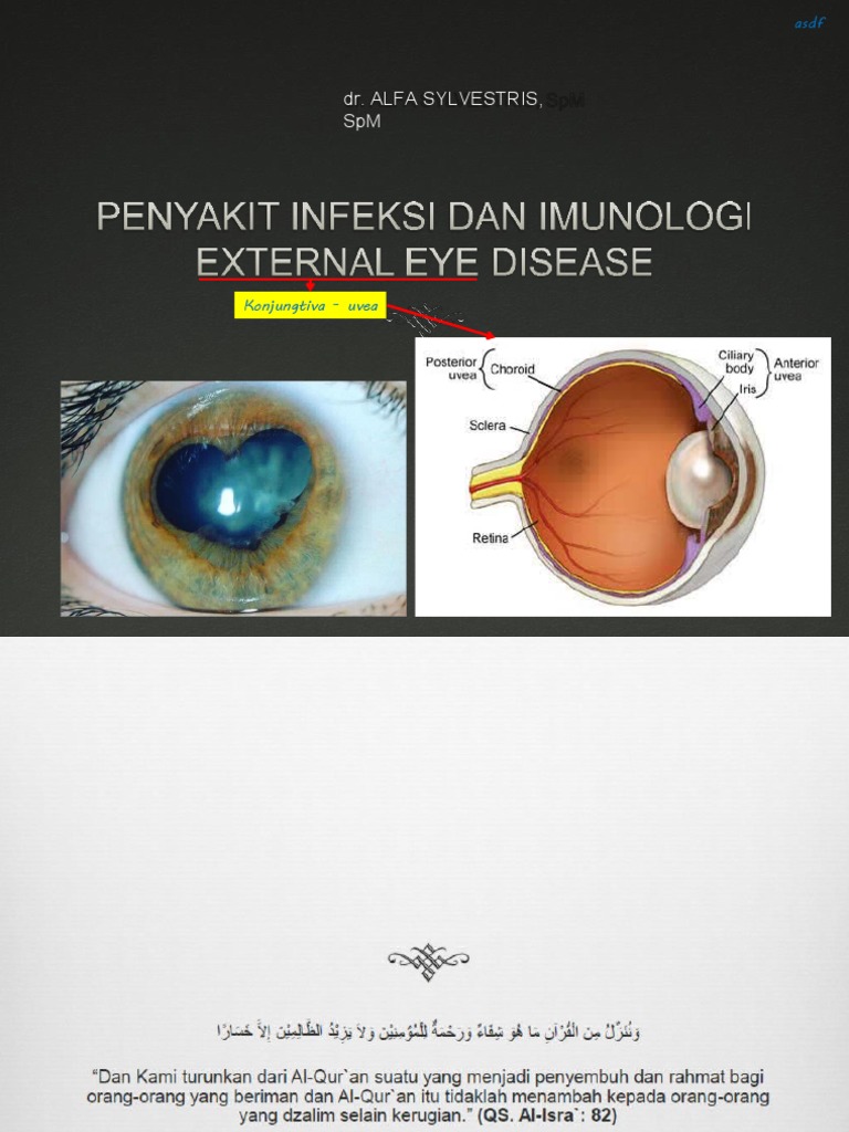(Upgraded) Mata2 - Penyakit Infeksi Dan Imunologi Kornea, Uvea, Dan ...