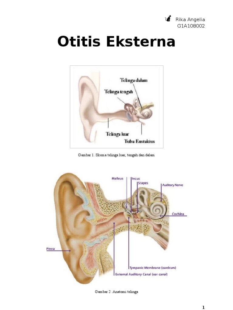 Otitis Eksterna | PDF | Kesehatan Holistik | Sains & Matematika