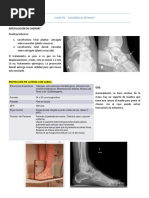 Comparativa: Ángulos de Meary y Costa-Bartani | PDF | Pie | Sistema ...