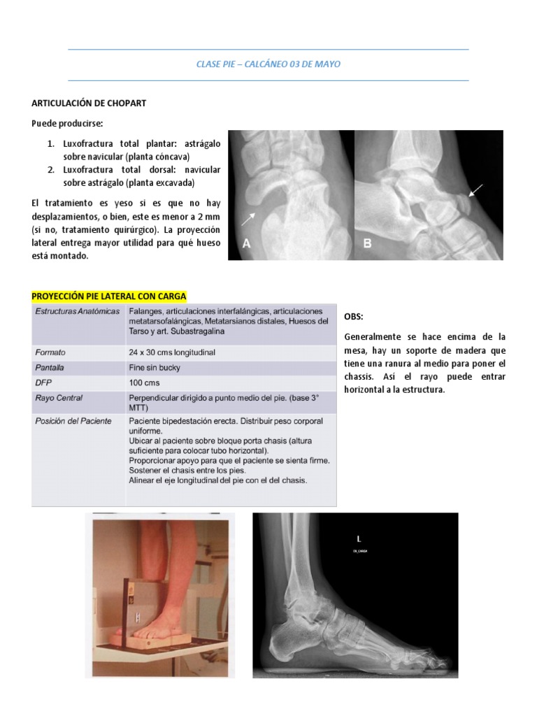 Pryecciones Pie RX | PDF | Pie | Tobillo