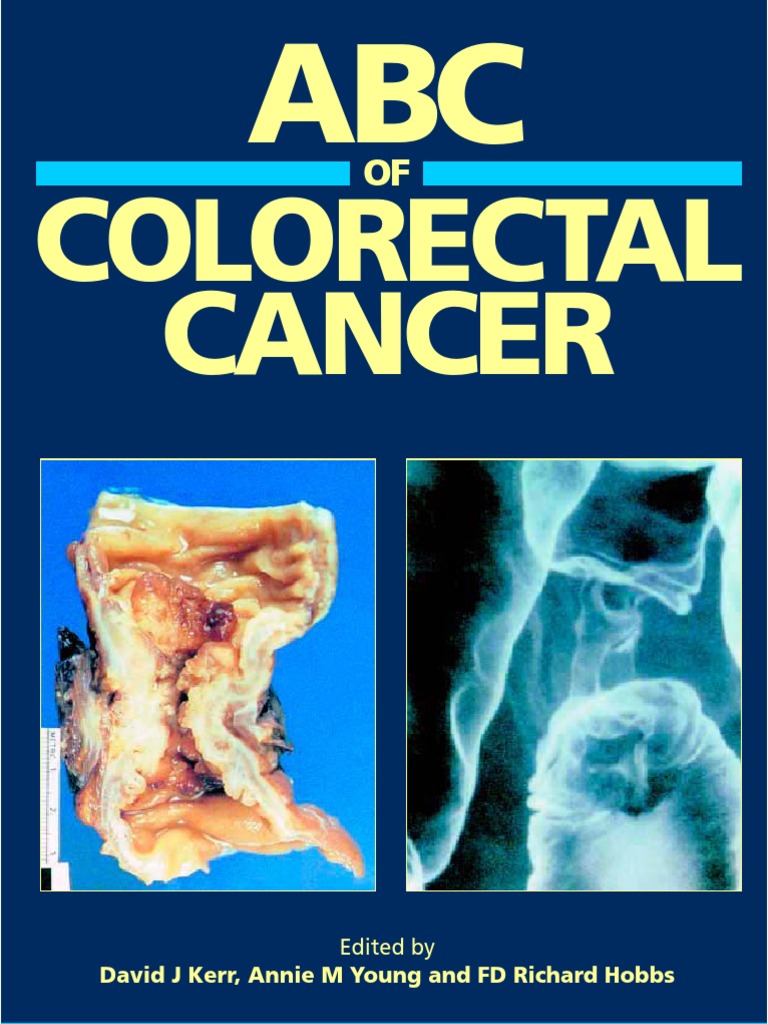 ABC of Colorectal Cancer | PDF | Colorectal Cancer | Dietary Fiber