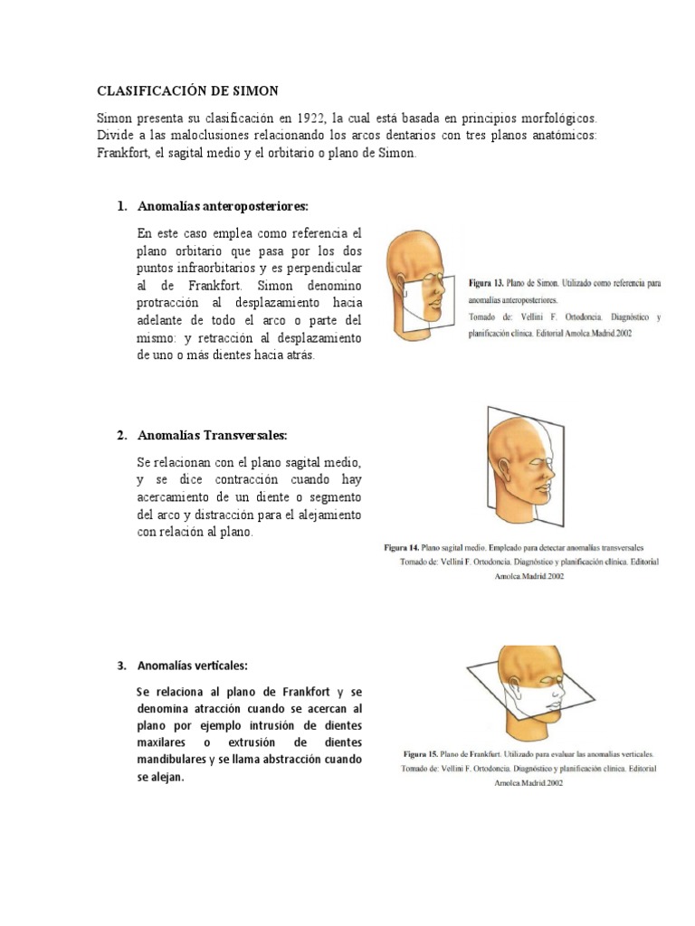 Clasificación de Simon | PDF