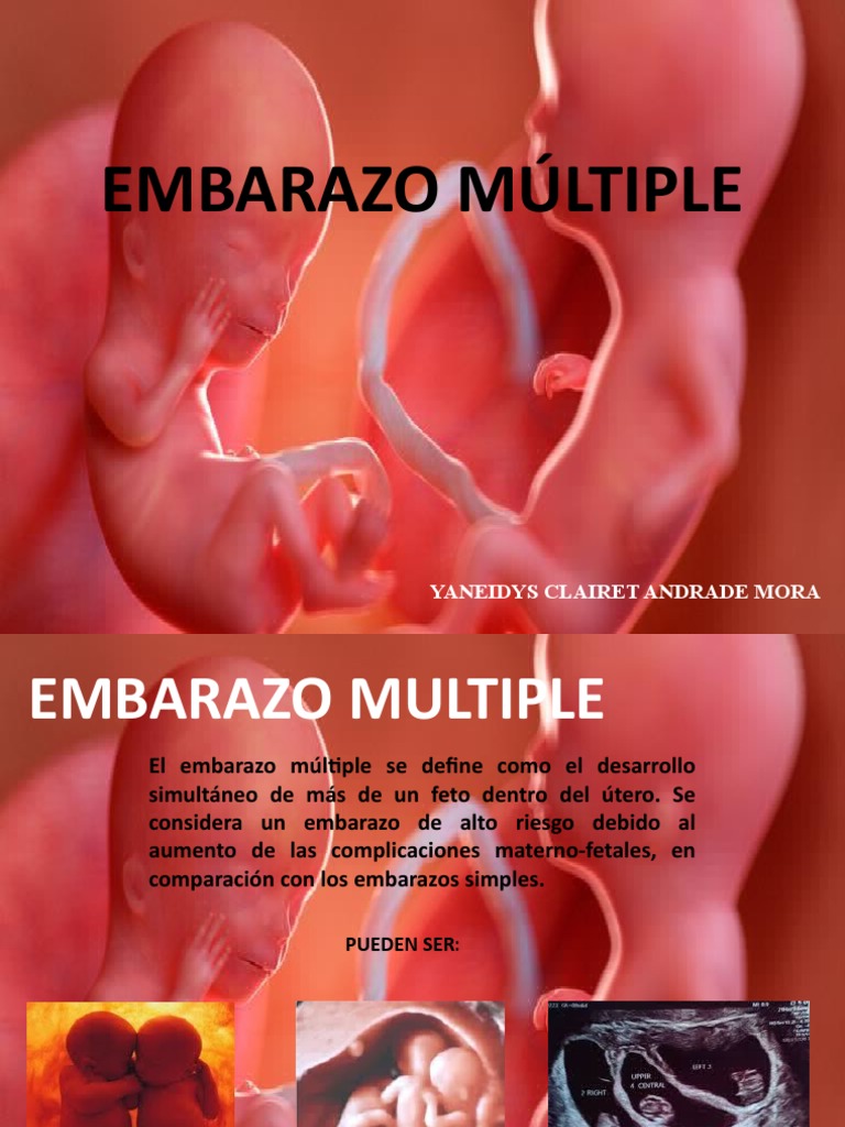 Embarazo Multiple Pdf El Embarazo Gemelo