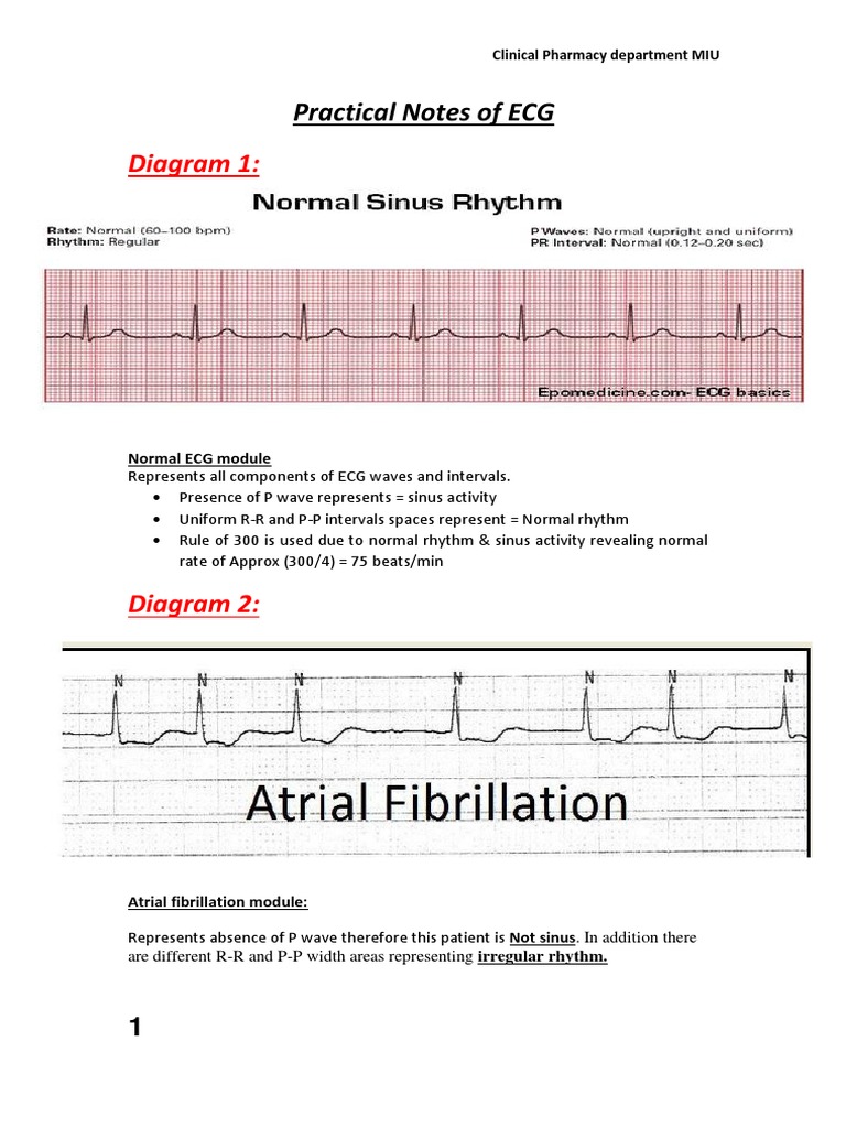 Ecg Charts - PDF Final - Doc 2016 | PDF | Electrocardiography | Heart Rate