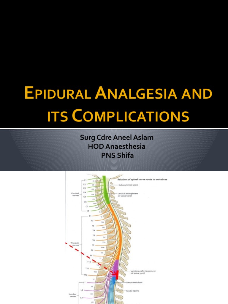 Epidural Analgesia and Its Complications | PDF