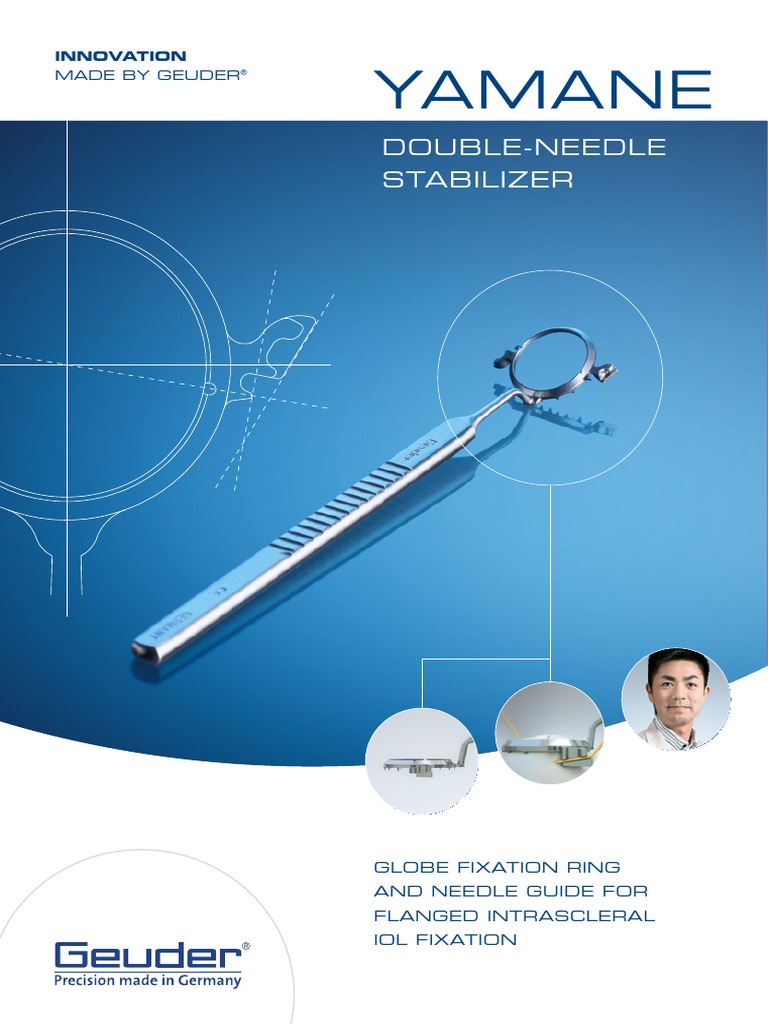 Yamane Instrument Flange IOL Technique | PDF | Human Eye | Ophthalmology