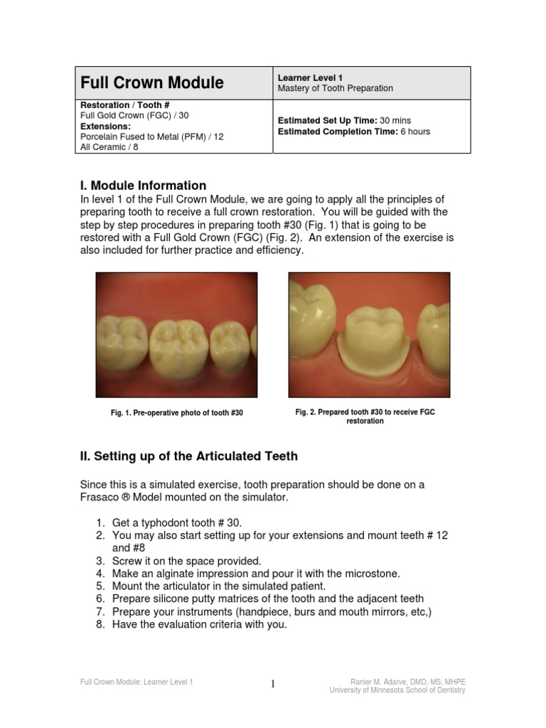 Full Crown Module | PDF | Mouth | Dentistry