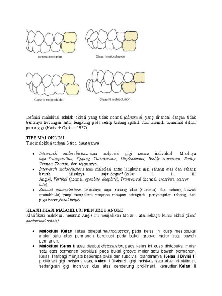 Maloklusi Dental | PDF