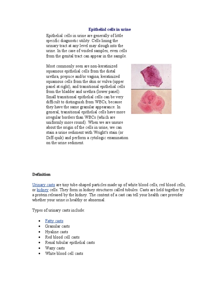 Epithelial Cells in Urine: Urinary Casts Kidney | PDF | Medical ...