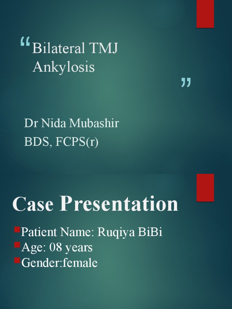 Kaban Protocol for TMJ Ankylosis Management | PDF | Human Head And Neck ...