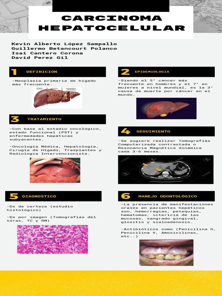 Carcinoma Hepatocelular | PDF
