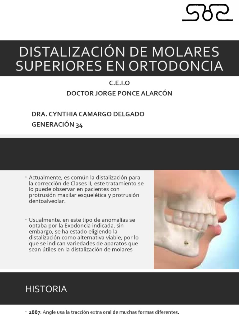 6.distalización de Molares Superiores en Ortodoncia | PDF | Ortodoncia ...