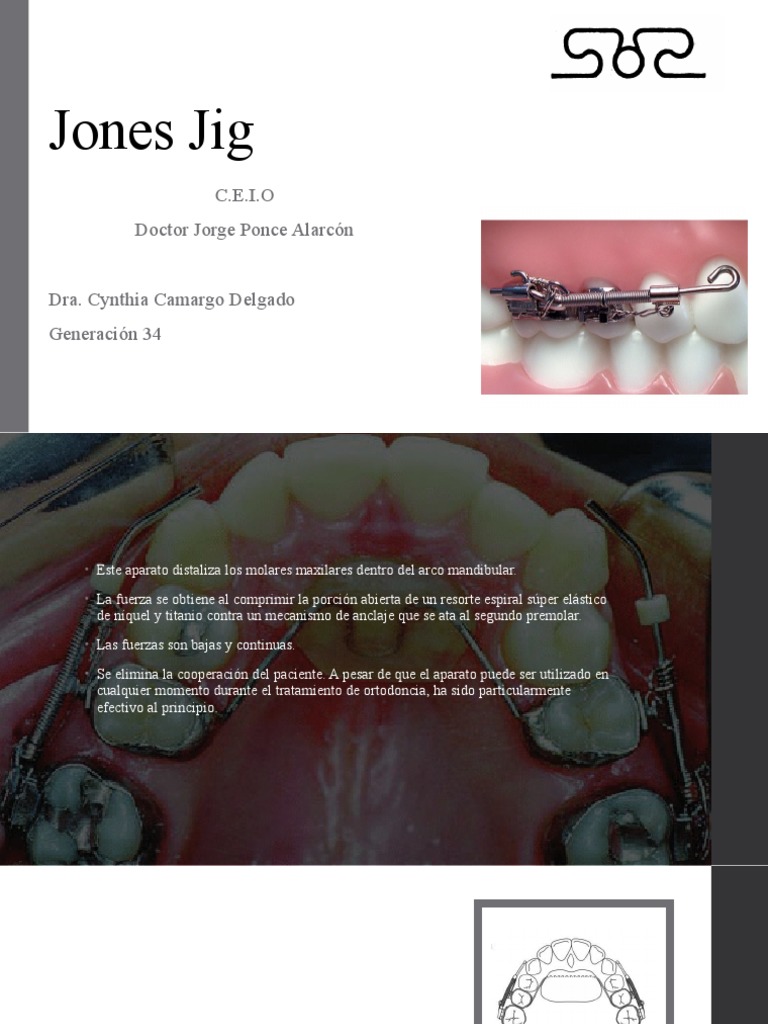 8.jones Jig | PDF | Ramas de Odontología | Boca
