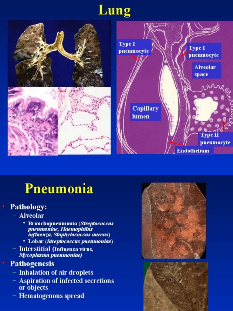 Type I Pneumocyte Type I Pneumocyte Alveolar Space: Capillary Lumen ...