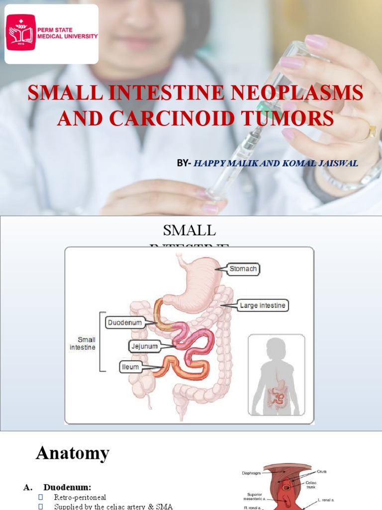 Small - Intestinal Neoplasms and Carcinoid Tumors | PDF | Lymphoma ...