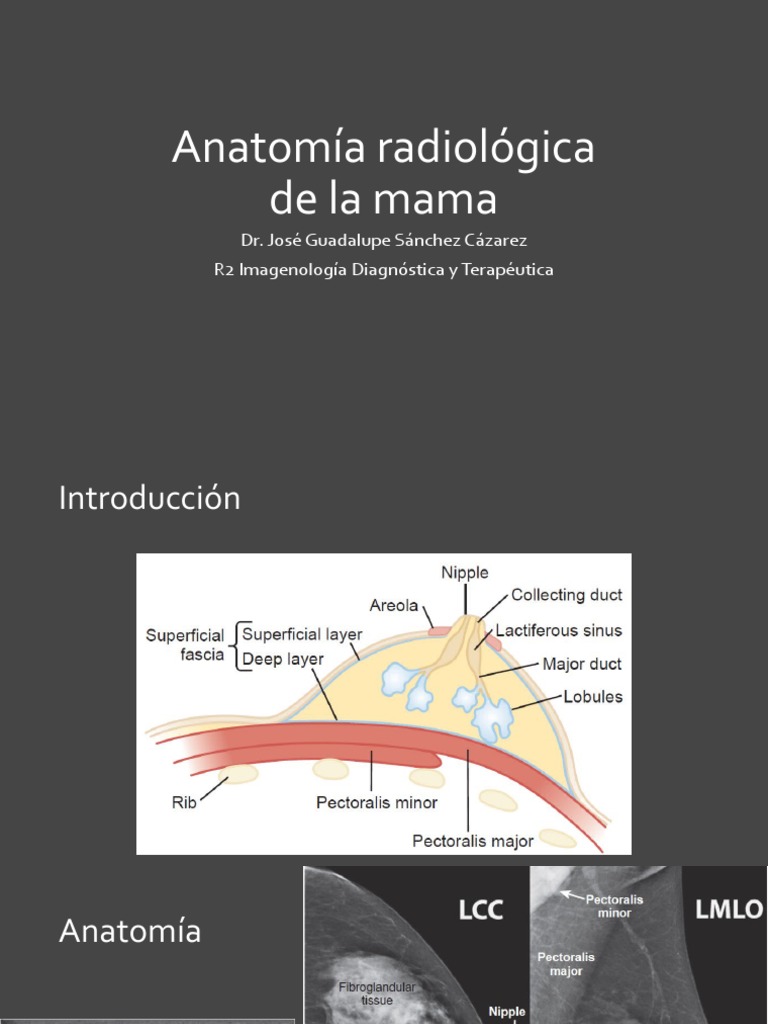 Anatomía Radiológica de La Mama | PDF