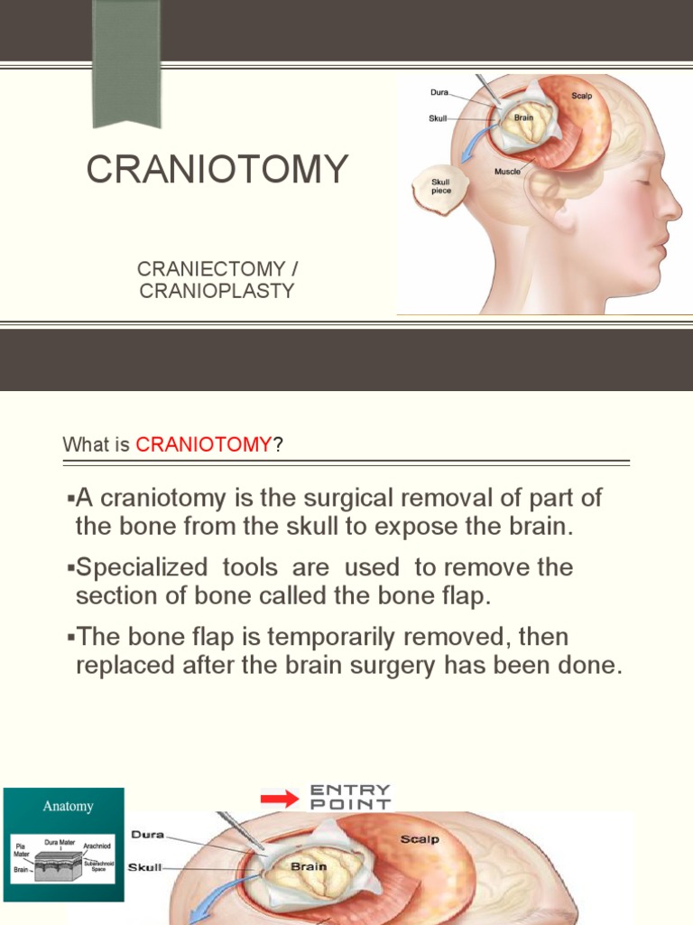 Craniotomy: A Guide to Brain Surgery | PDF | Surgery | Clinical Medicine