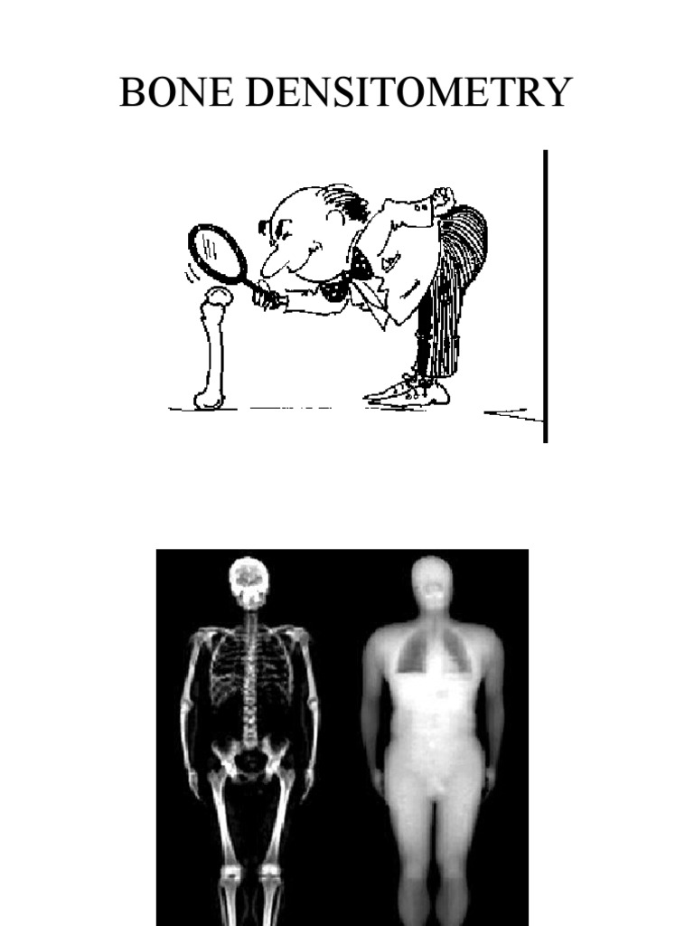 Bone Densitometry | PDF | Osteoporosis | Bone