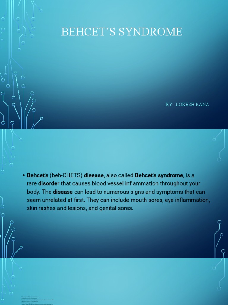 Behcet's Syndrome | PDF | Immunology | Epidemiology