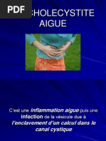 Critères de Tokyo pour cholécystite aiguë | PDF | Vésicule biliaire | Médecine clinique