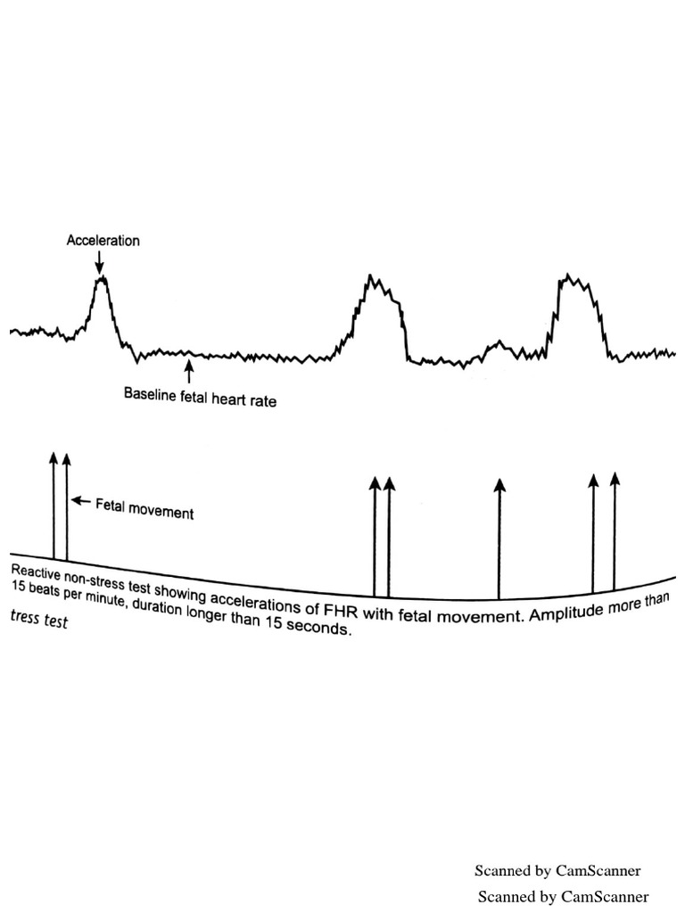 Obs Diagrams 1 | PDF