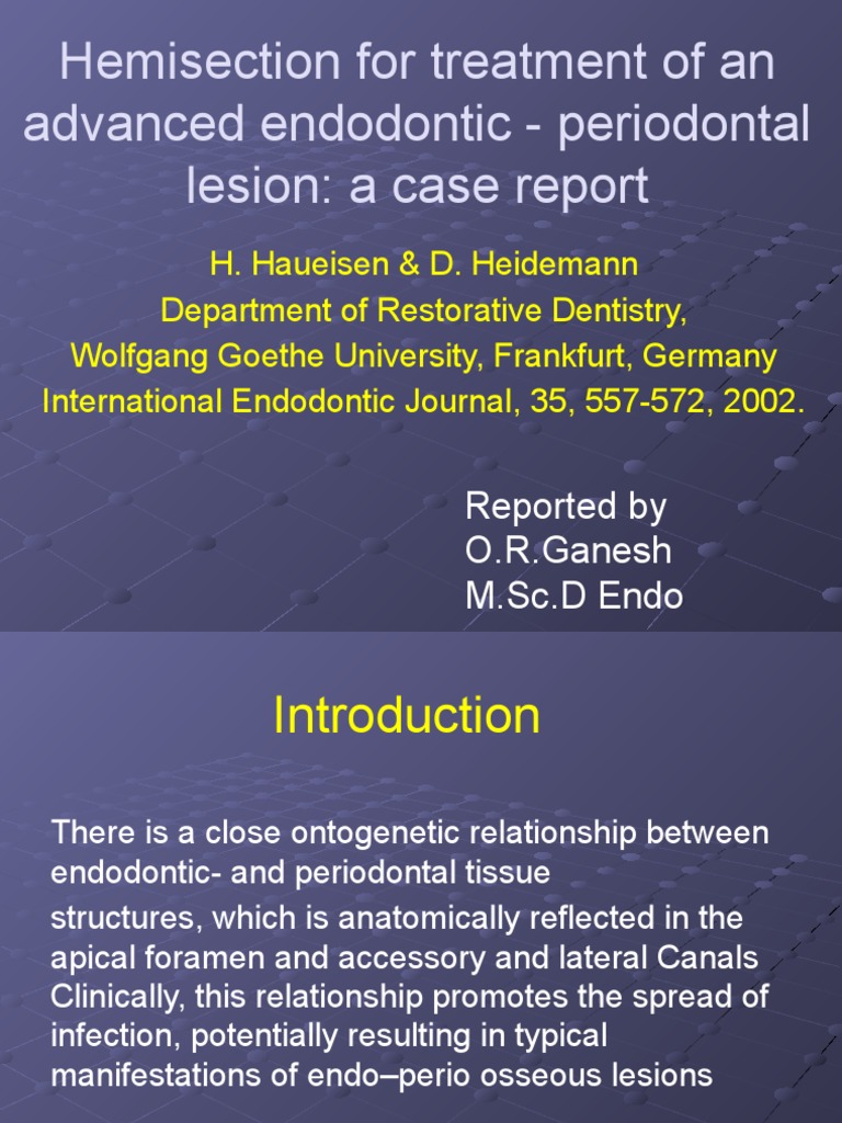 Hemisection For Treatment of An Advanced Endodontic - Periodontal ...