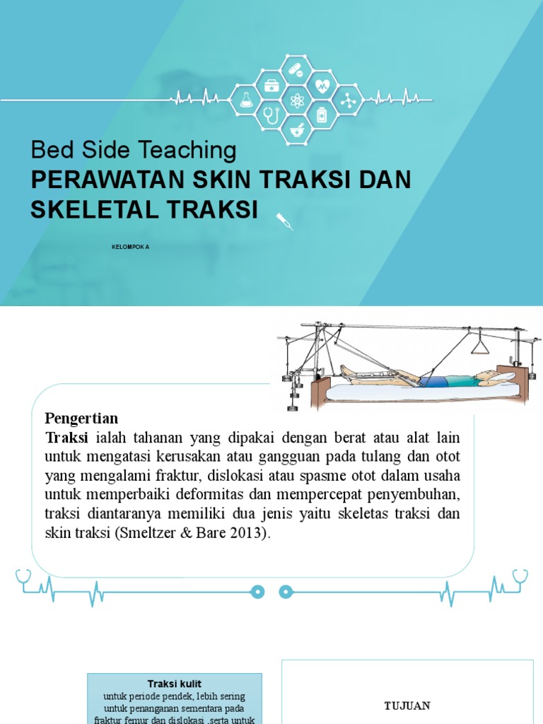 Perawatan Traksi Kulit dan Skeletal | PDF