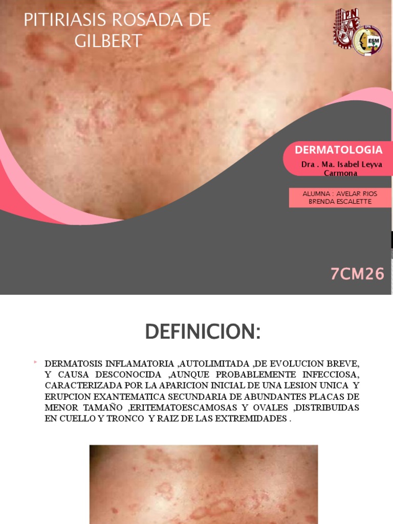 Pitiriasis Rosada de Gilbert | PDF | Piel | Medicina CLINICA