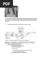 Interpretasi Spirometri | PDF