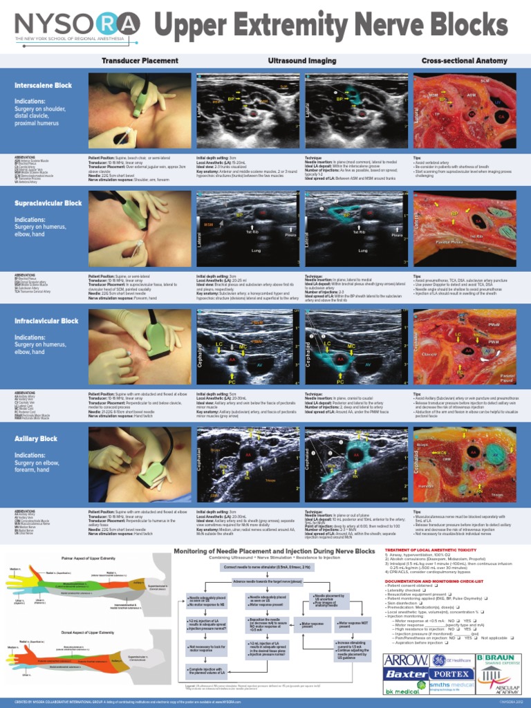 Upper Extremity Nerve Blocks Guide | PDF | Elbow | Arm