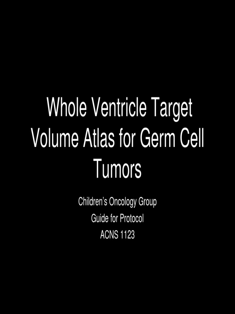 Whole Ventricle Target Volume Atlas For Germ Cell Tumors: Children's ...