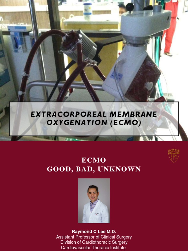 ECMO Overview: Types, Indications, and Risks | PDF | Cardiovascular ...