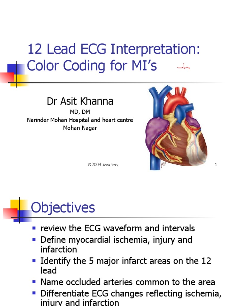 12 Lead ECG Interpretation: Color Coding For MI's: DR Asit Khanna | PDF ...