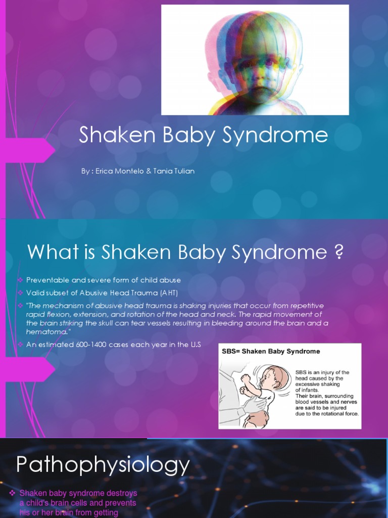 Shaken Baby Syndrome | PDF | Traumatic Brain Injury | Cerebrospinal Fluid