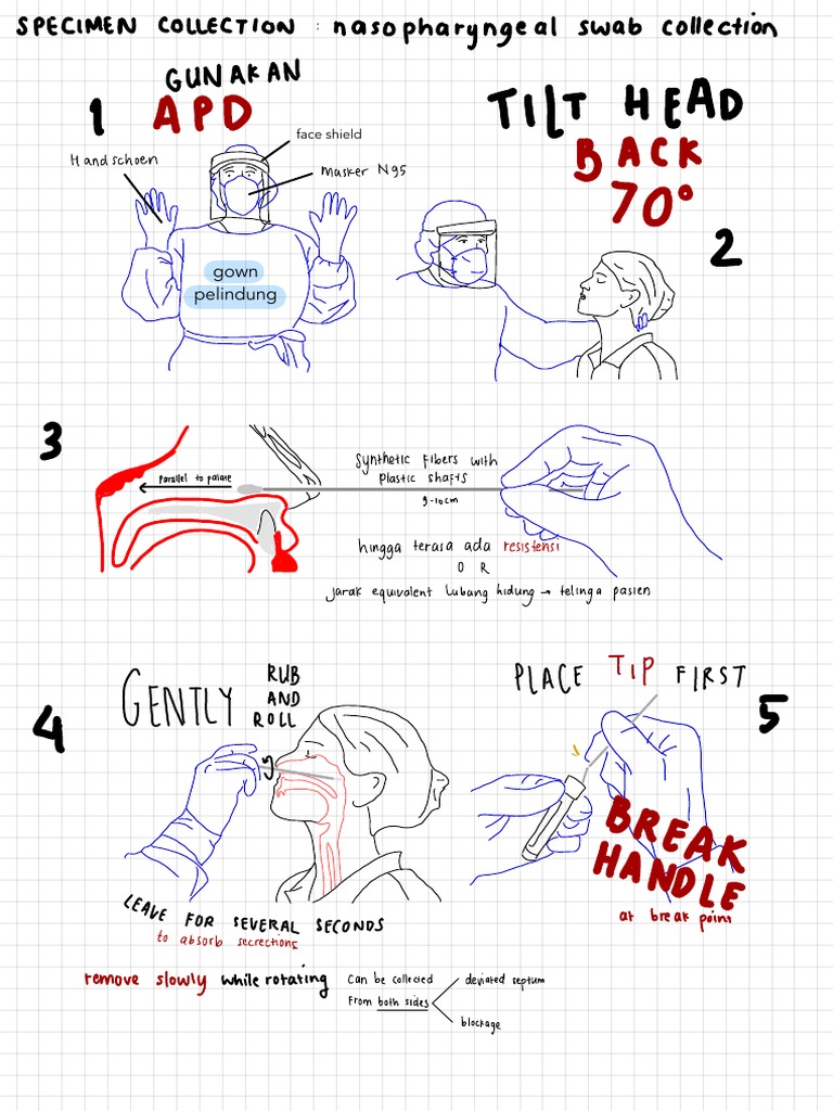 Specimen Collection: Instructions for Performing a Nasopharyngeal and ...