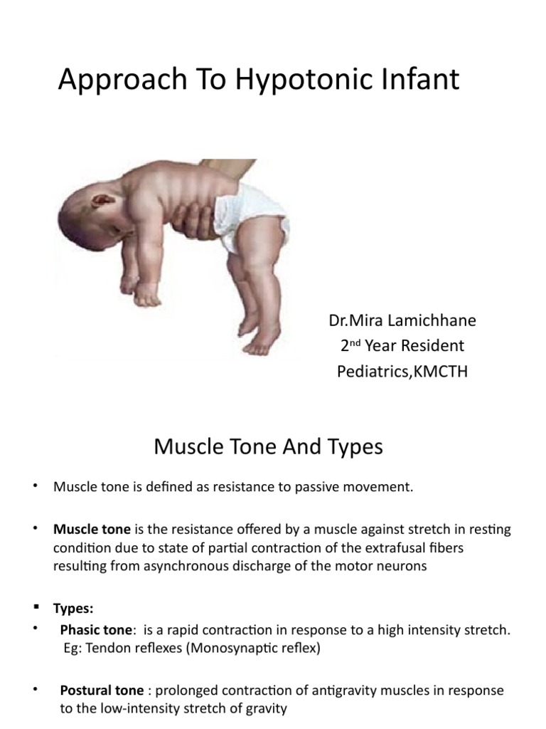Approach To Hypotonic Infant | PDF | Weakness | Muscle