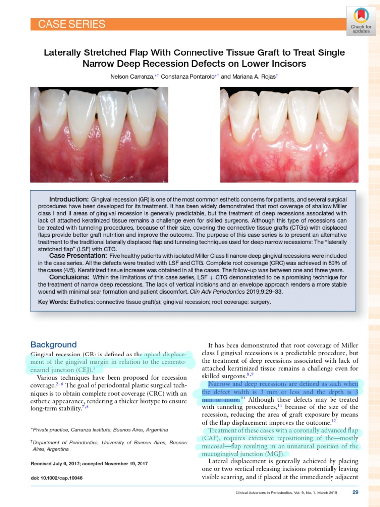 Case Series | PDF | Periodontology | Mouth