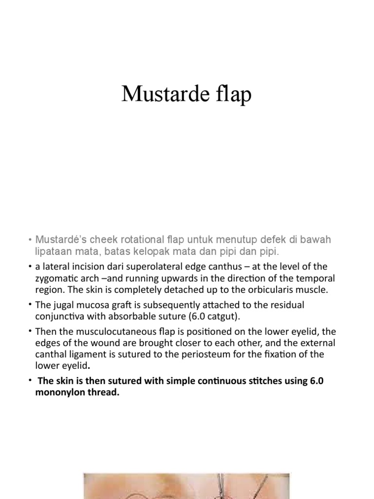 Mustarde Flap | PDF | Science & Mathematics