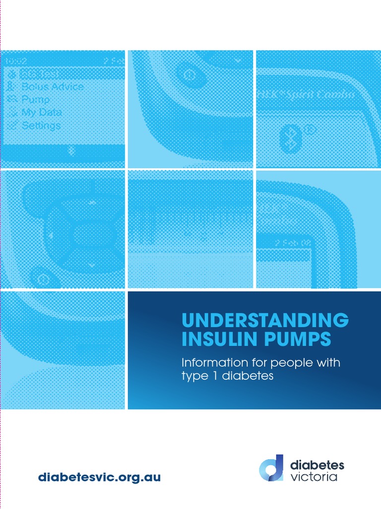 Understanding Insulin Pumps | PDF | Diabetes | Insulin