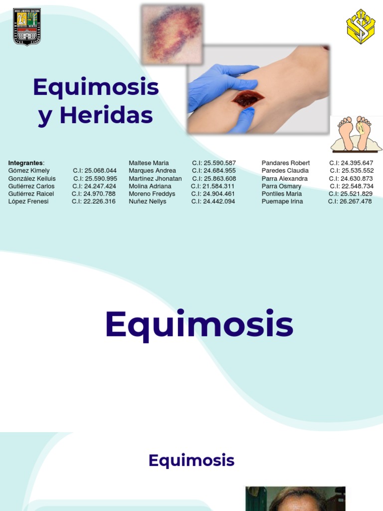 Equimosis y Heridas | PDF | Derecho penal | Sangre