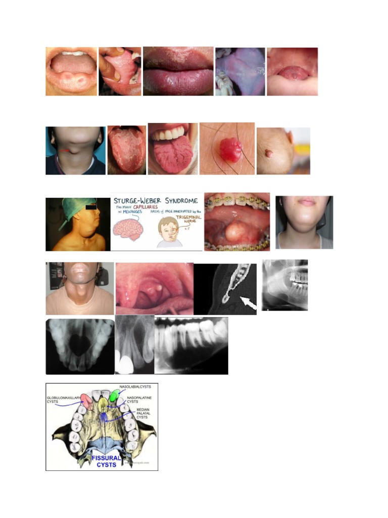 Oral Pathology | PDF