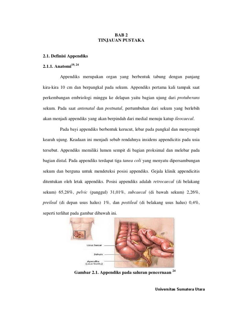 Appendicitis Perforasi | PDF