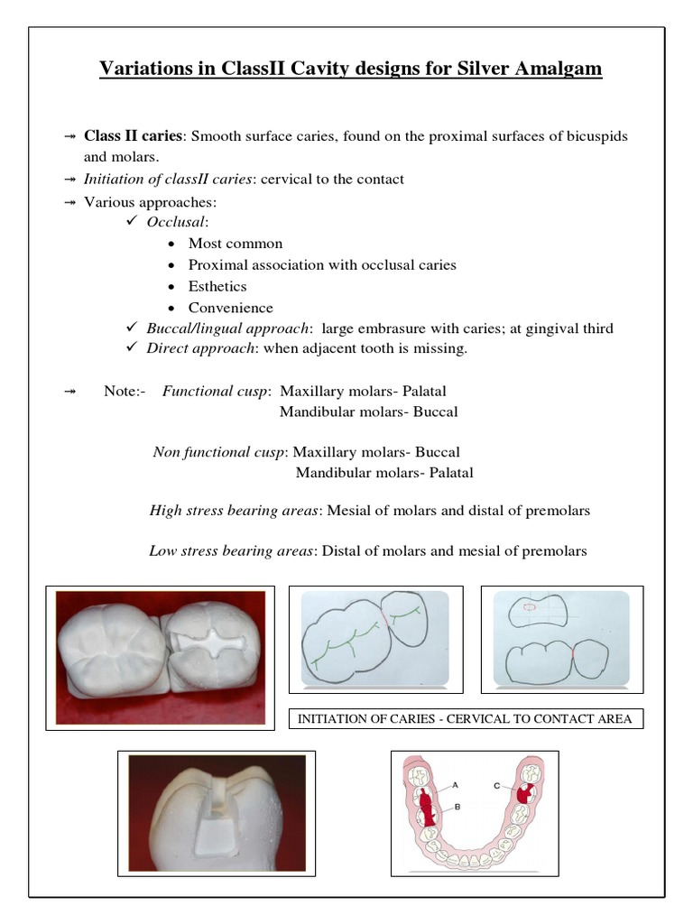 Class 2 Cavity Designs For Amalgam | PDF | Tooth Enamel | Tooth