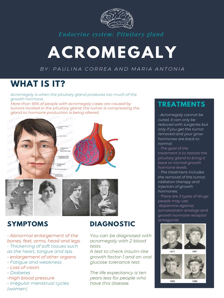 Acromegaly: What Is It? | PDF | Endocrine System | Medical Specialties