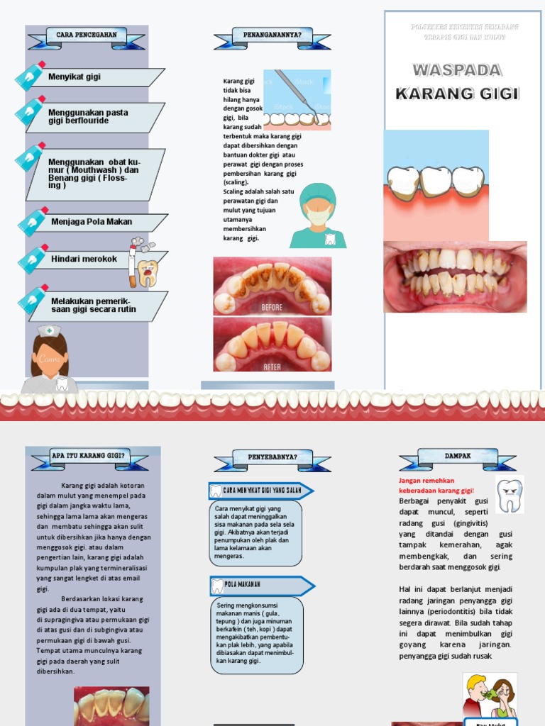 Leaflet Karang Gigi | PDF